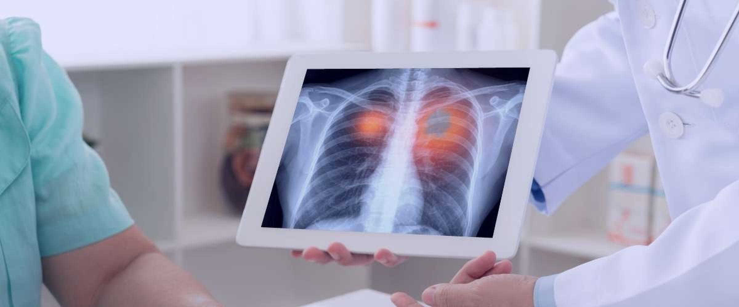 A patient's guide to lung cancer prevention and treatment in Singapore ...